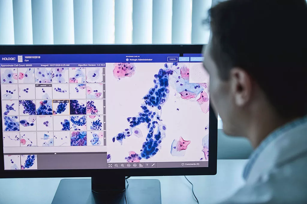 Genius™ Digital Diagnostics | AI based Cytology | Hologic® UK